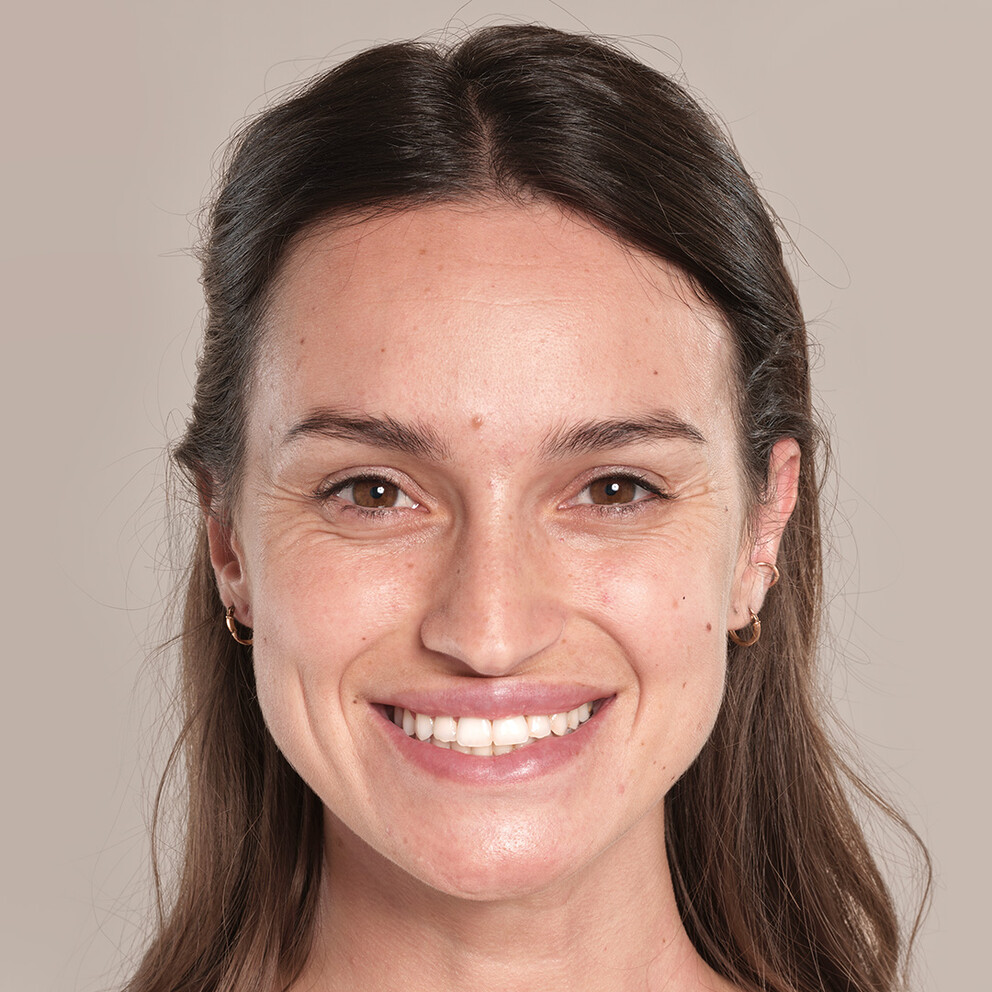 Discover Teoxane’s Range of Dermal Fillers: Effective Non-Surgical ...