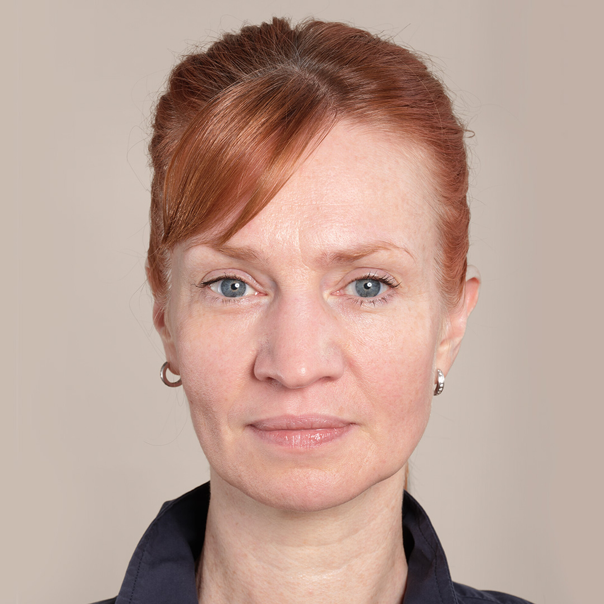 Dermal Fillers | Teoxane