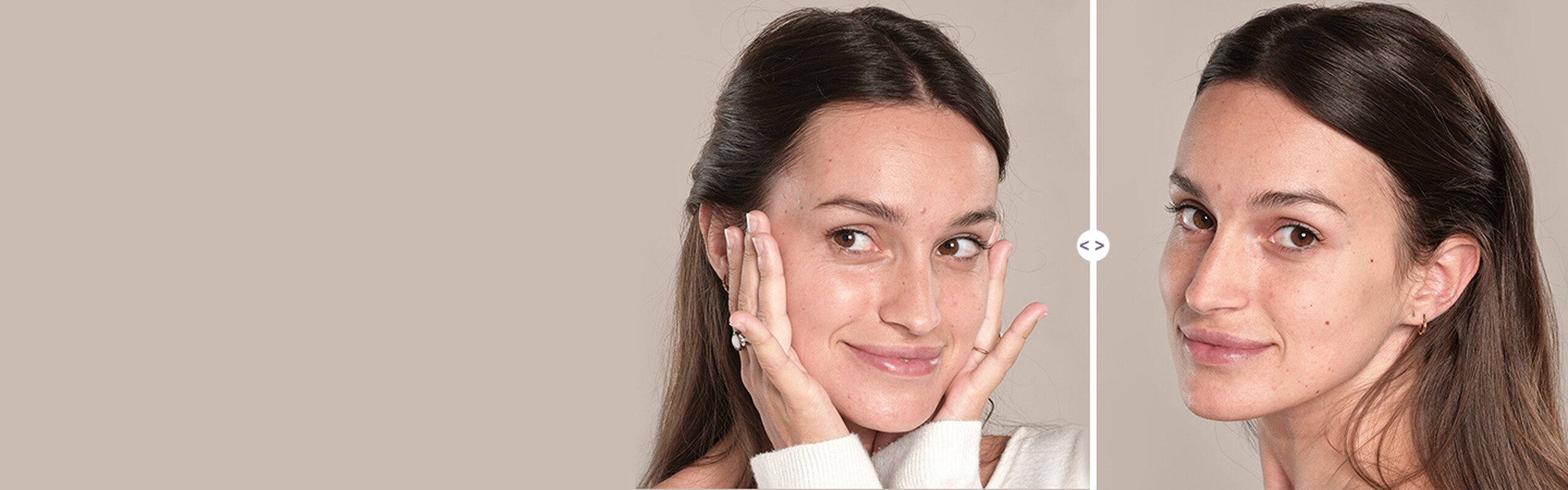 Teoxane UK: Advanced Hyaluronic Acid Skincare & Anti-Aging Solutions ...