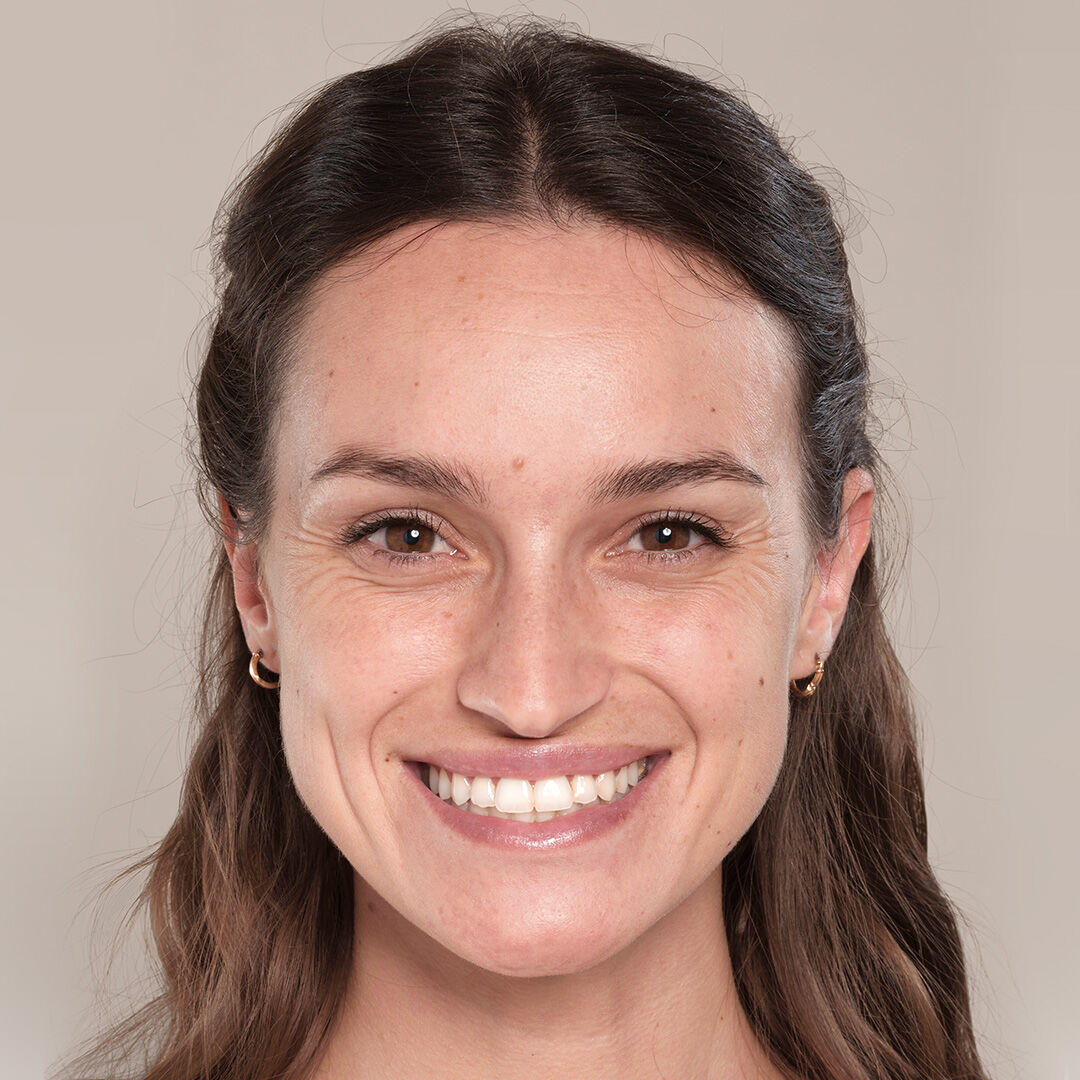 What is RHA® ? | Teoxane