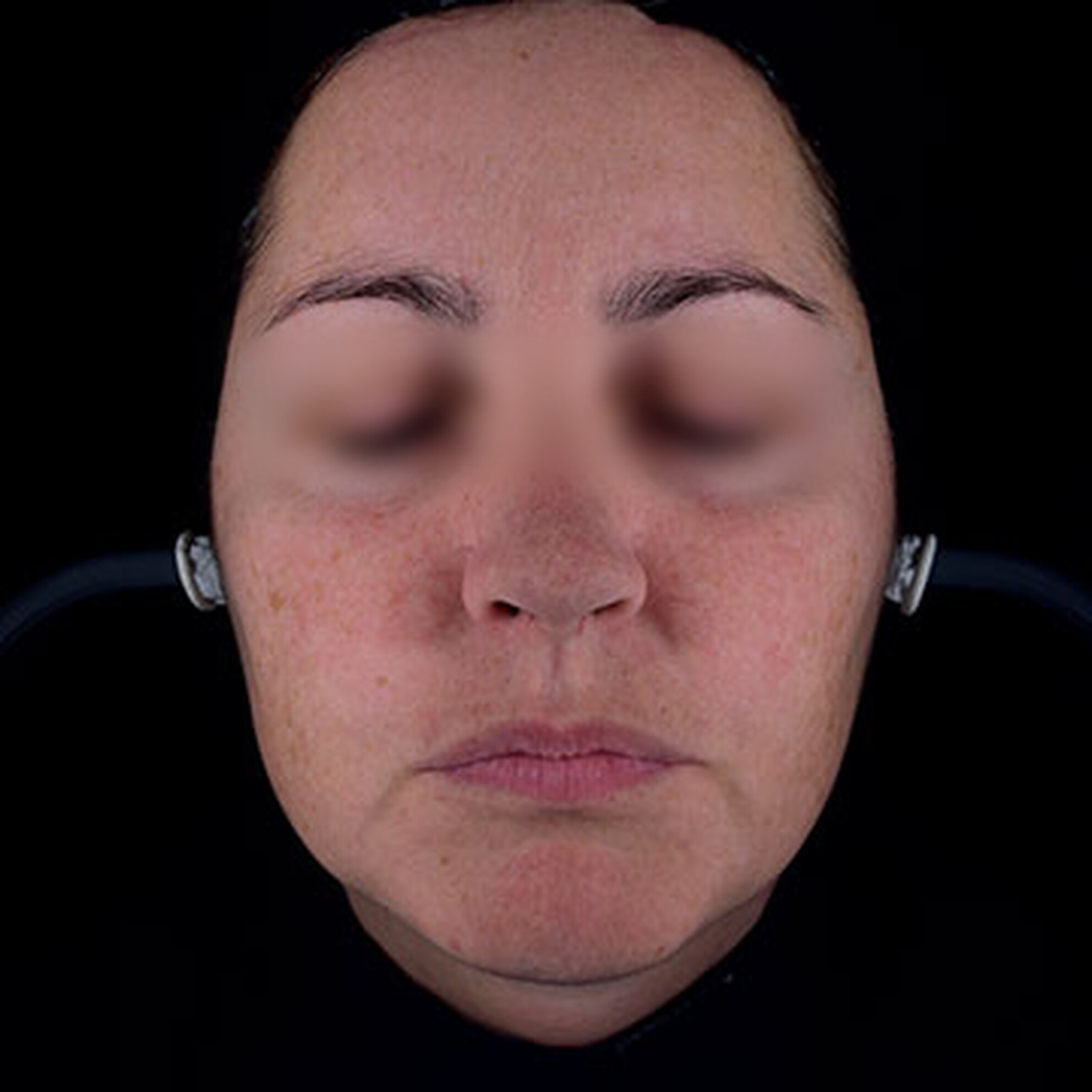 Achieve Luminous Skin with Teoxane’s Brightening Routine: Daily ...
