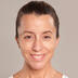 Discover Teoxane’s Range of Dermal Fillers: Effective Non-Surgical ...