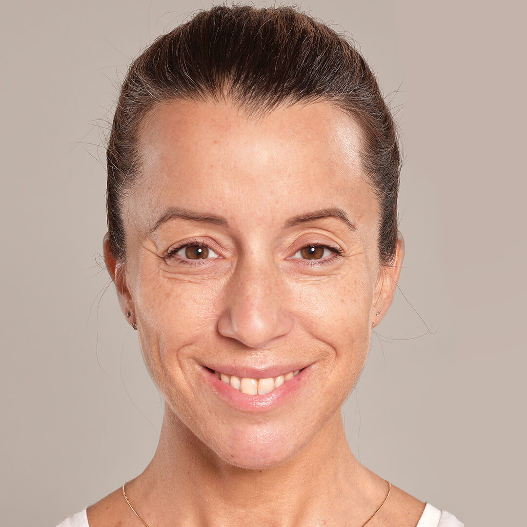 Dermal Fillers | Teoxane