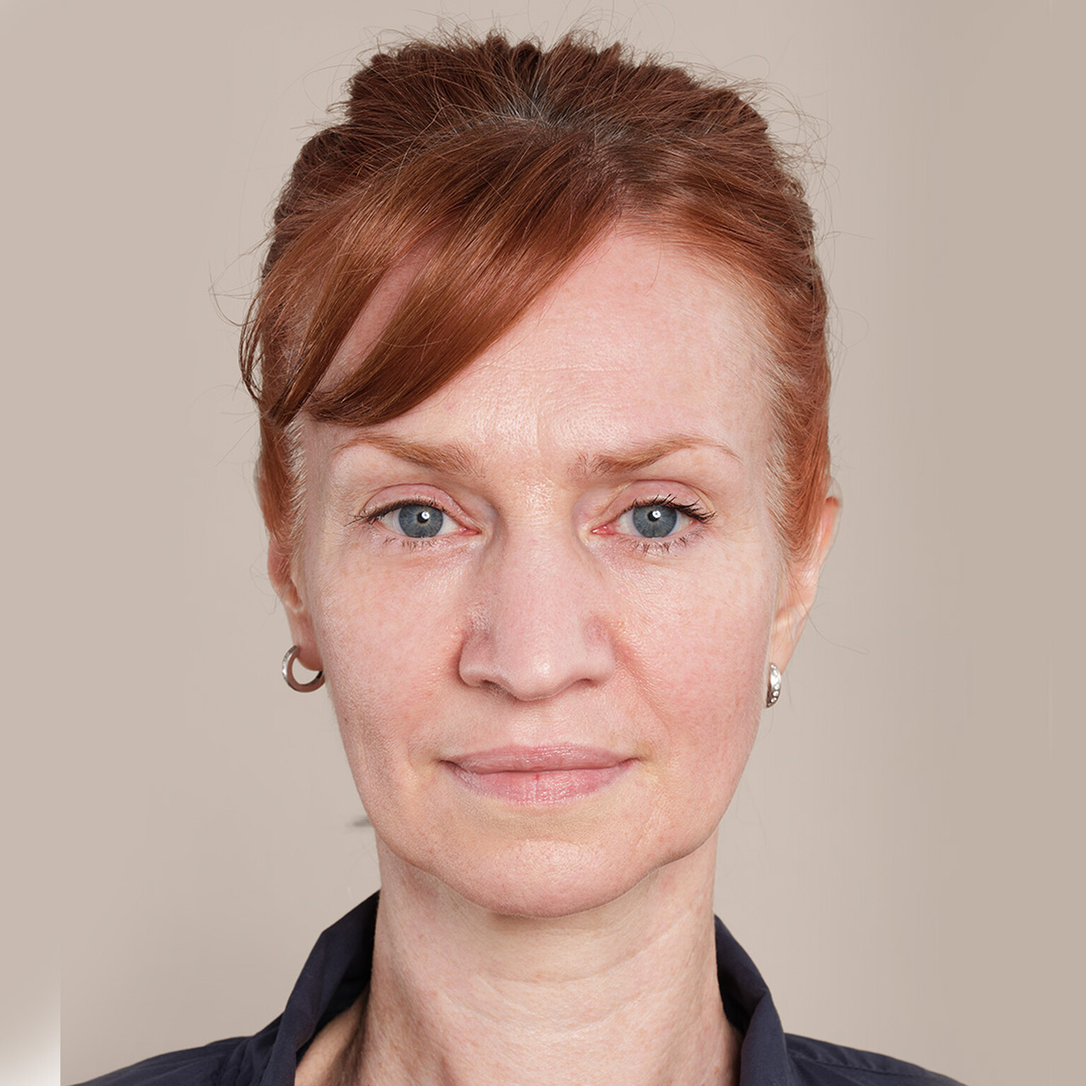 Dermal Fillers | Teoxane